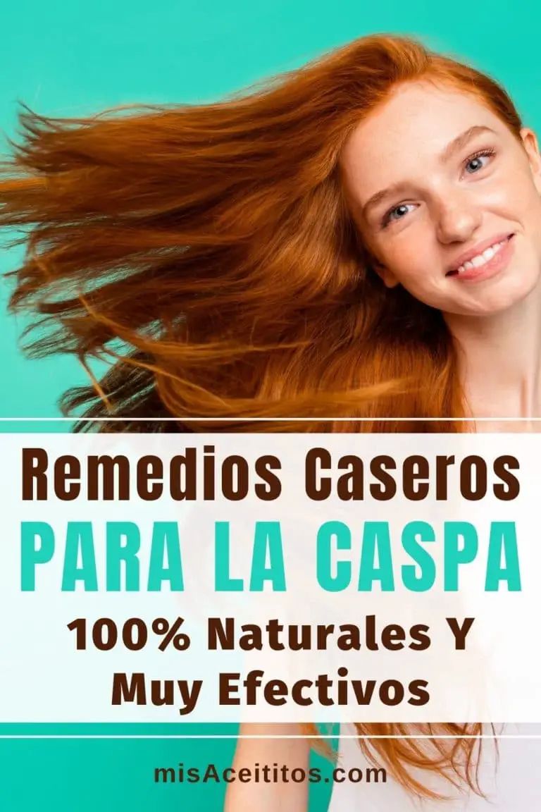 Remedios para la Caspa Caseros Súper Sencillos y 100% Naturales